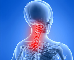 Cervical Pain Disorder: SpineandNeuroSurgeryHospitalIndia.Com